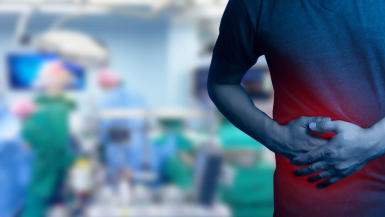 Biaya Operasi Usus Buntu Tanpa BPJS & Pilihan Rumah Sakit | MUFDana